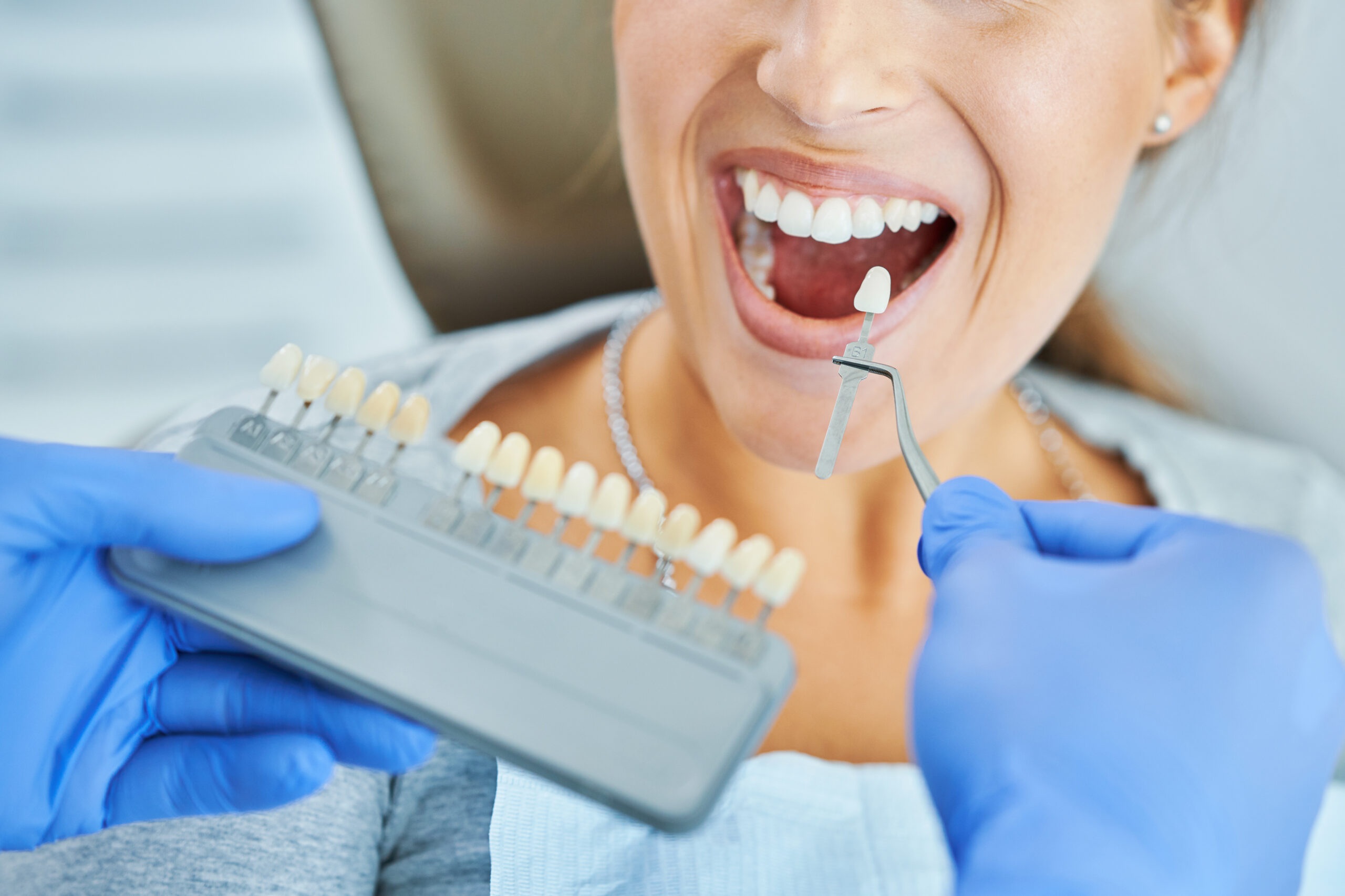 The Connection Between Dental Veneers and Tooth Sensitivity ...